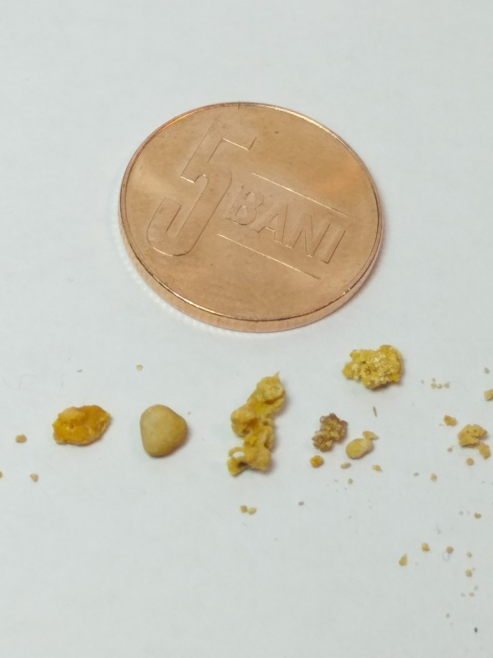 Tratament naturist pietre la rinichi si bila, Renoregim (resolutivo ...